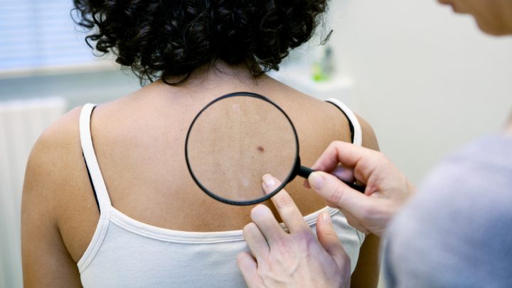Non-Melanoma Skin Cancers | SRT and Mohs Maryland | Mid-Atlantic Skin