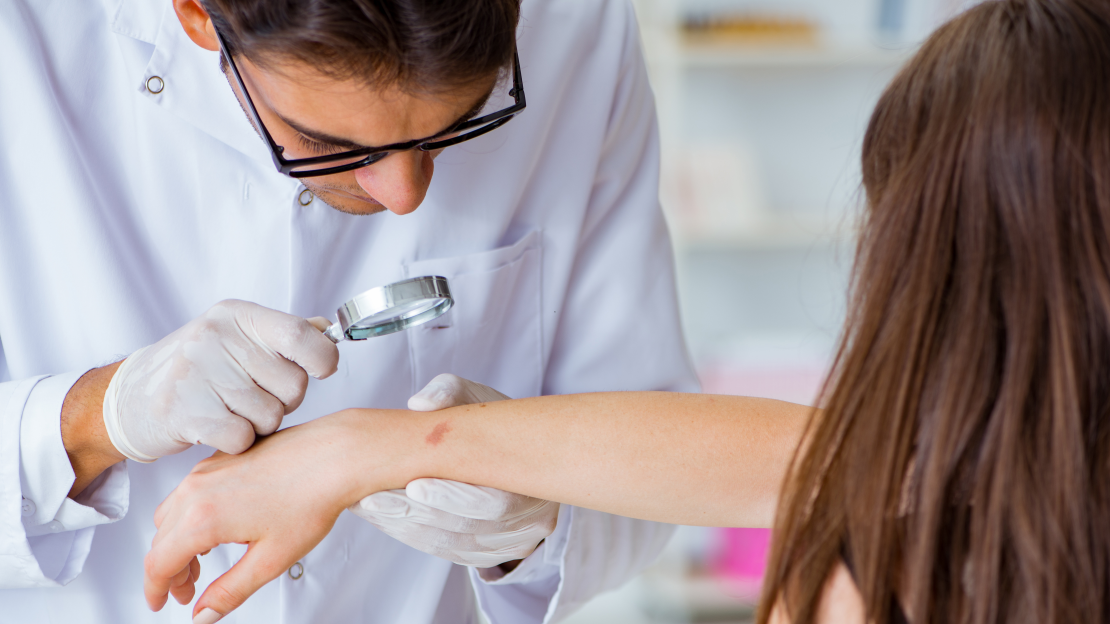 Signs It's Time to Visit The Best Skin Cancer Center in Maryland - Mid ...