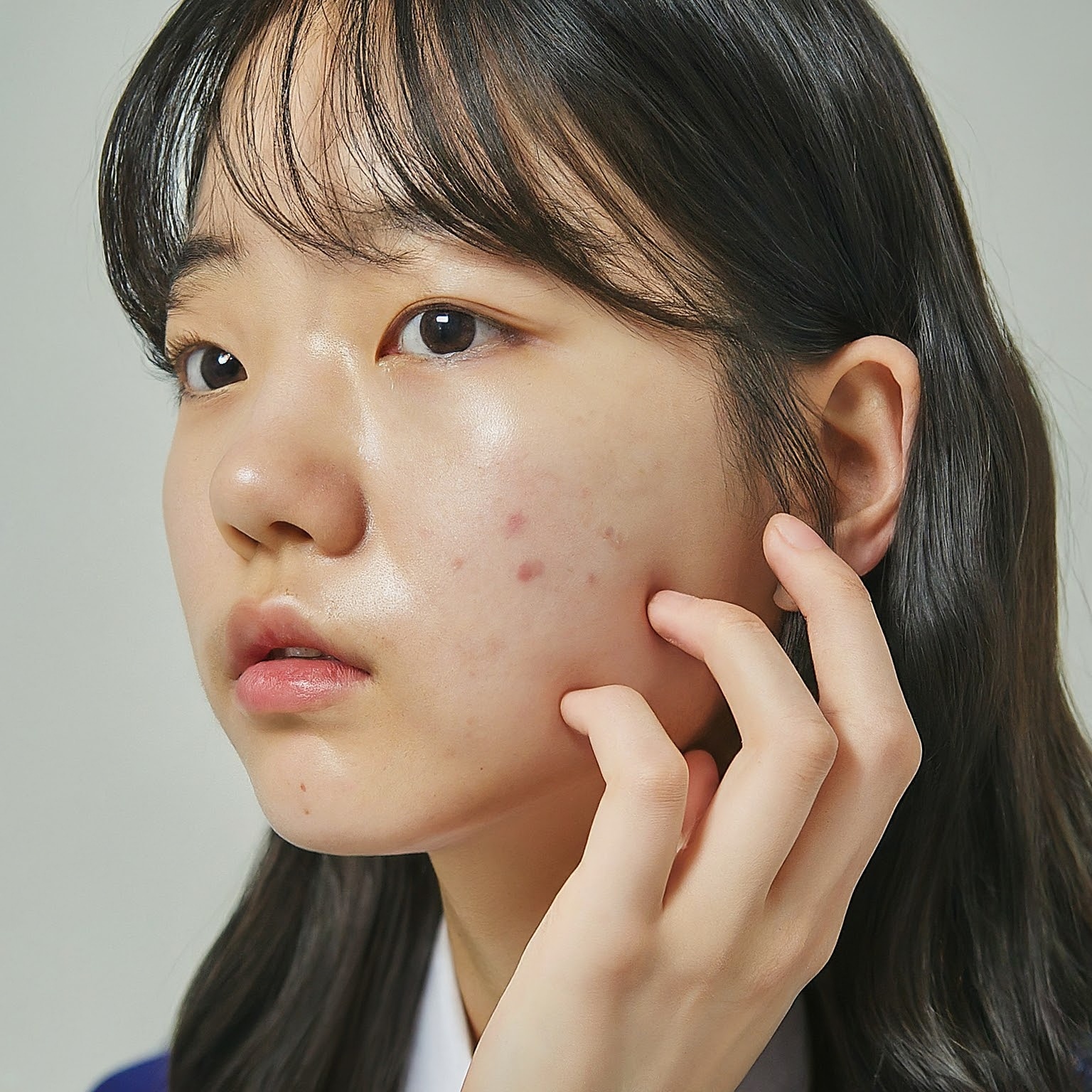 5 Simple Steps to Find the Best Acne Doctor in Prince Frederick ...
