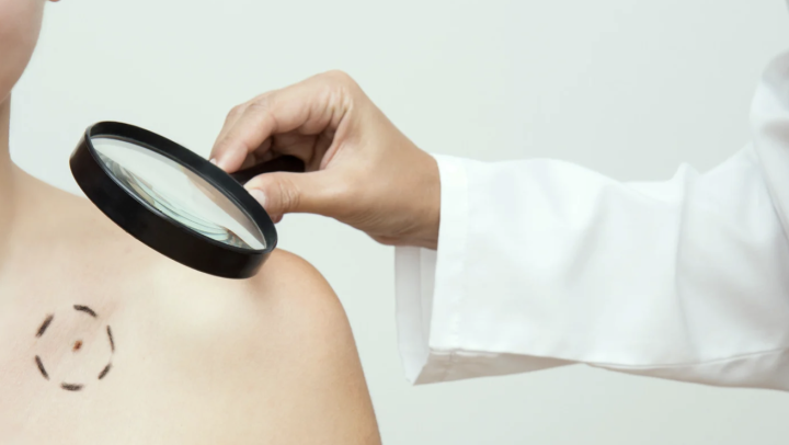 Skin Cancer Screening Archives - Mid-Atlantic Skin Surgery Institute