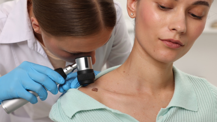 Top Tips for Your Mole Check and Skin Cancer Screening Appointment in ...