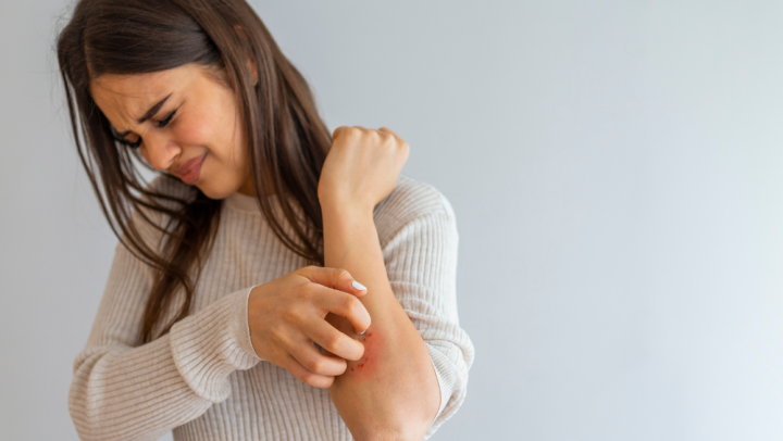 When to Book a Skin Rash and Itching Evaluation Appointment in Dunkirk ...